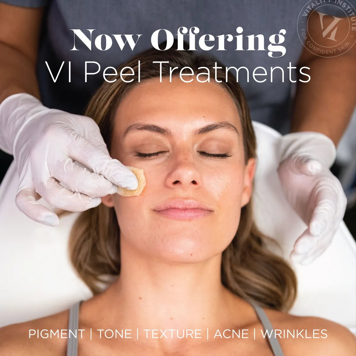 VI Peel Advanced McMinnville | Vitality Institute Chemical Peel | MC ...